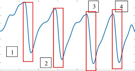 Obtained Read Back Signals Fig 6 Shows Skipping Line Signals From Download Scientific Diagram
