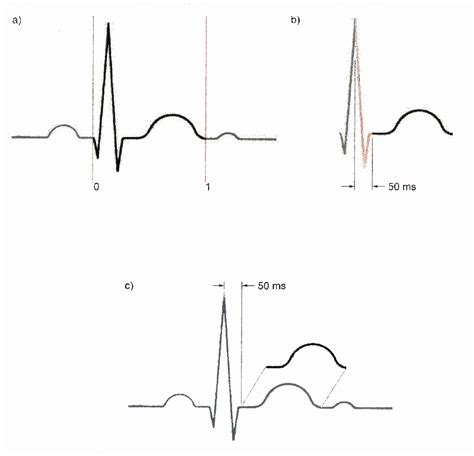 Figure 11 From Qt Variability Calculation Using A Template Matching