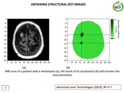 neuroimaging technique using time resolved diffuse optical tomography
