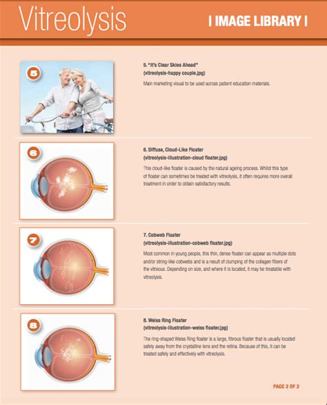 Eye Floater Treatment Chesapeake Va Laser Floater Treatment