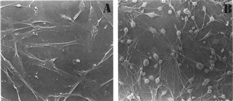 Stromal Cells Of The Endometrium And Decidua In Search Of A Name And An Identity†