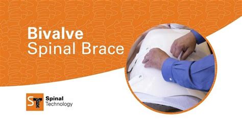 Spinal Technology Tlso Bivalve With Sternal Shield