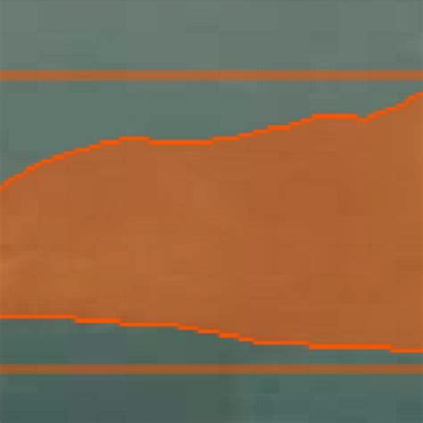 Examples Of True Positives Detected And Their Segmentation Outlines Download Scientific