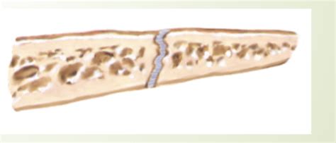 Lec 1 Msk Flashcards Quizlet