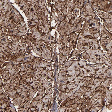 Rabbit Polyclonal Anti Cd36 Antibody Buy For Research Highly
