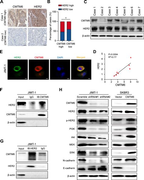 Cmtm6 Directly Interacts With Her2 And Enhancing The Her2 Signaling In