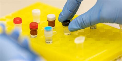 Mdx Chex For Bcid2 Molecular Control Streck