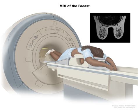 Breast Cancer Ucsf Plastic Surgery Integrated Residency Program