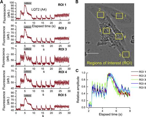 Comparing Spontaneous And Caffeine Evoked Ca 2 I Transients In