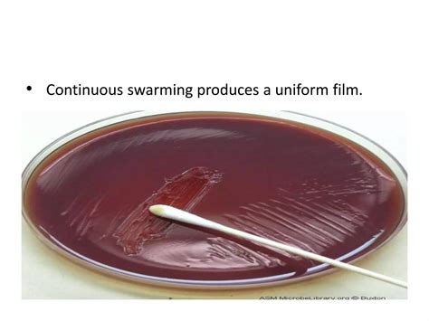 Proteus Spp Lecture Pptx