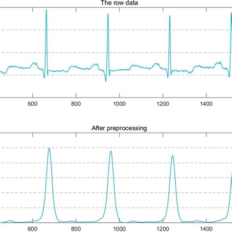 Waveform Comparison Of Record No 100 In Mit Bih Before And After