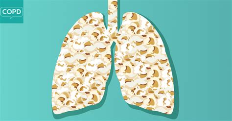 Popcorn Lung Copd Lunges Popcorn