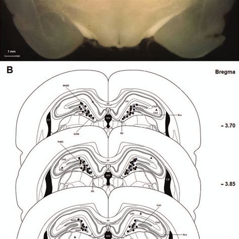 A A Coronal Photomicrograph Of Microinjection Site Showing The Download Scientific Diagram