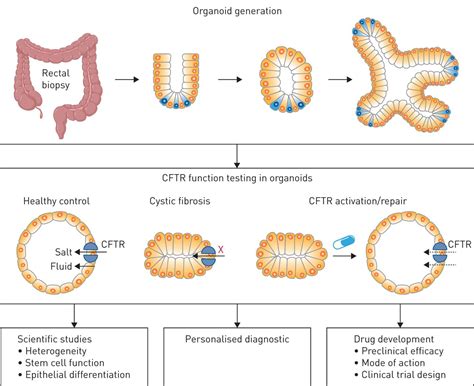 Organoids For Cystic Fibrosis And The Living Cancer Facellitate