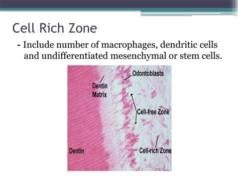 Histology Of Pulp Pptx Dental Health Diseases And Conditions