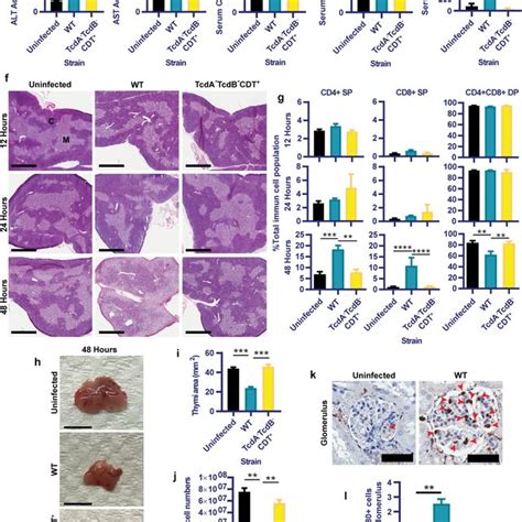 Toxigenic M WT C Difficile Infection Results In Systemic Organ Download Scientific