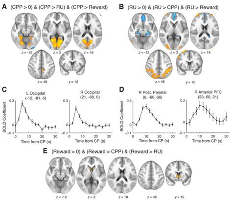 Brain Regions Selectively Sensitive To Cpp Ru Or Reward A Regions Brain Regions Selectively Sensitive To Cpp Ru Or Reward A Regions