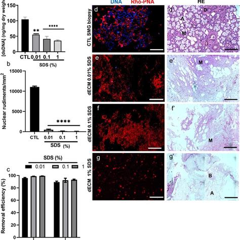 After Decellularization With 0 1 And 1 Sds Perfusion Treatments Download Scientific Diagram