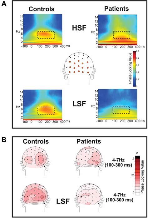 Frequency Domain Analysis Of Event Related Spectral Perturbations