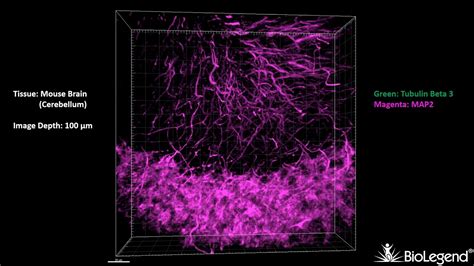 3 D Ihc Mouse Brain Cerebellum Tubulin Beta 3 Tubb3 Map2 Youtube