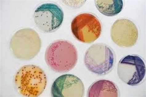 Microbiological Culture Media Chromogenic Agar Media Trader