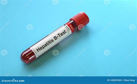 Hepatitis B Virus Test Stock Illustration Illustration Of Medicine