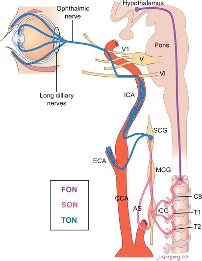 Horners Syndrome Clinical And Radiographic Evaluation Radiology Key