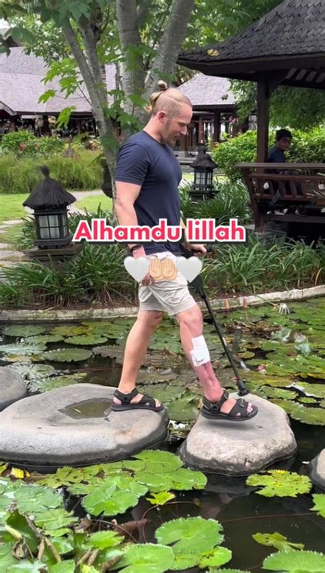 Alami Kecelakaan Hingga Kaki Patah And Harus Jalani 5 Operasi Seperti