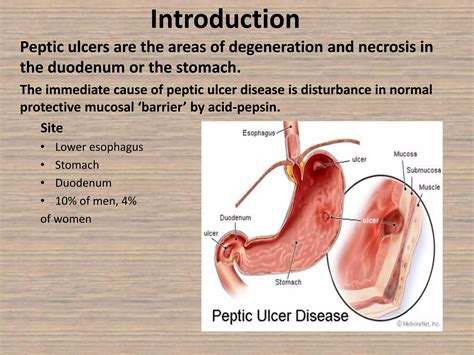 Pepticulcerdiseaseppt