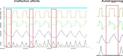 Ineffective Efforts And Auto Triggering Download Scientific Diagram