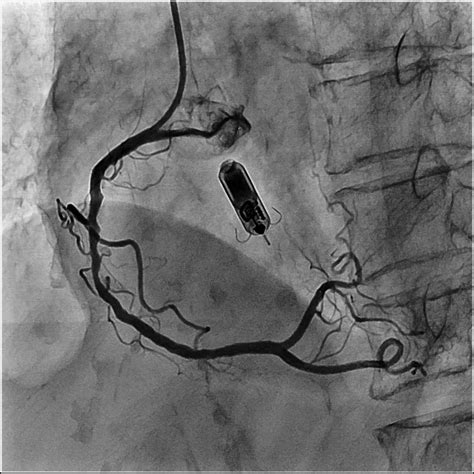 Trinias Unity Edition B12 C16 C12 F12 Shimadzu Europa Medical