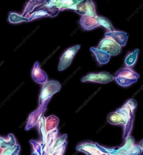 Mycoplasma Genitalium Bacteria Tem Stock Image C0455926 Science