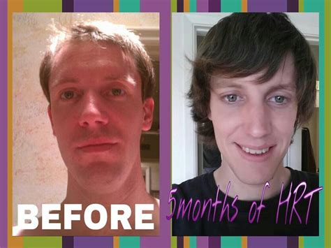 My Trans Mission • This Is My Face And Body After 5 Months Of Hormone