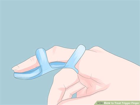 How To Treat Trigger Finger 8 Steps With Pictures WikiHow