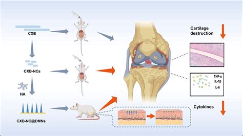 Celecoxib Nanocrystal Loaded Dissolving Microneedles With Highly Efficient For Osteoarthritis