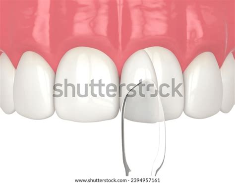 Matrix Teeth Over 203 Royalty Free Licensable Stock Illustrations And Drawings Shutterstock