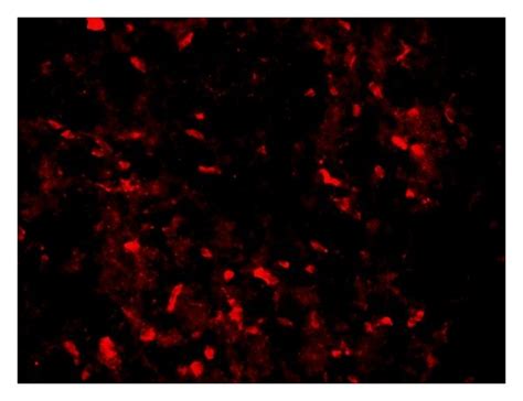 Scutellarin Decreases The Number Of Activated Microglia In Brain Of