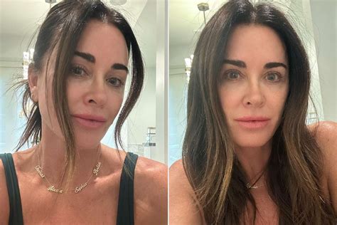 Kyle Richards Posts Makeup Free Selfies After Brow Microblading Lip