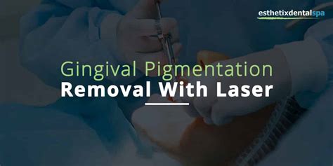Gingival Pigmentation Esthetix Dental Spa Dentist In Nyc