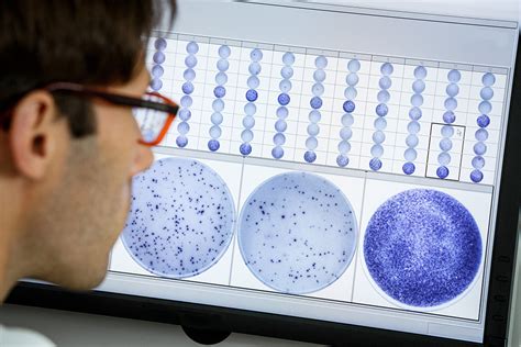 Lab Spot Counting Bioscience Today