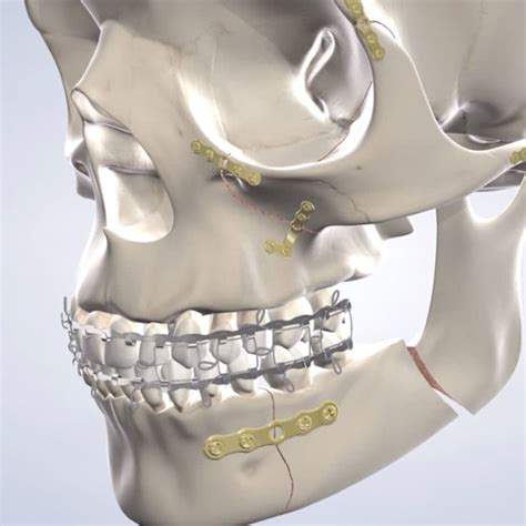 Oral Surgery Premier Oral Surgeon In Los Angeles
