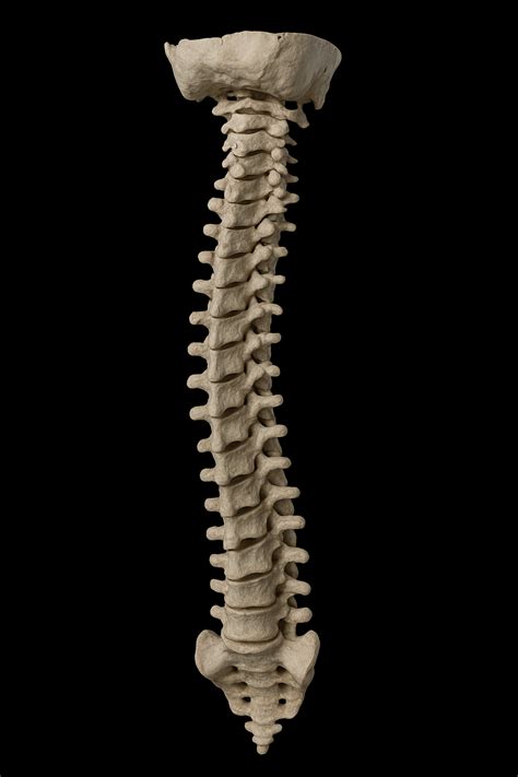 Radiographic Gyan What Is Perfusion What Is Ct Perfusion Why Do Ct Perfusion Why Dr Ct