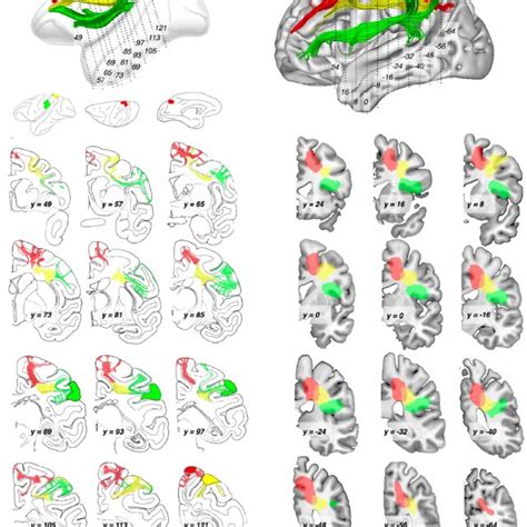 Pdf A Lateralized Brain Network For Visuo Spatial Attention