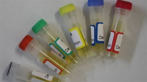 Benefits Of Eqa Uk Neqas Microbiology