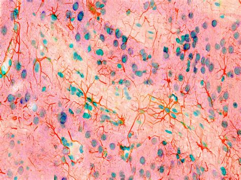 Stained Rat Brain Section Nikon Small World