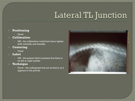 Ppt Radiology Project 2 Powerpoint Presentation Free Download Id4089