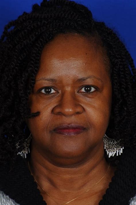 Patient 140130 Septoplasty Before And After Photos Matthew Bridges Md