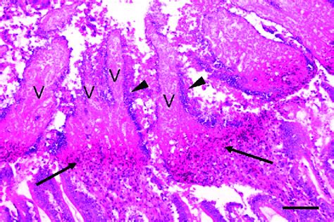 Small Intestine Of A Chicken With Naturally Acquired Necrotic Enteritis