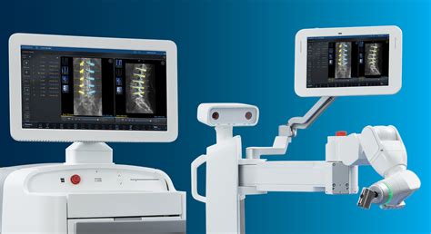 Mazor Spine Surgery Holland Hospital