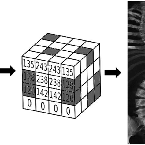 Schematic Presentation Of The Production Of Digitally Reconstructed